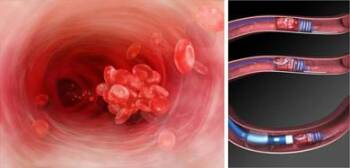 Blood Clots, Polymers and Strokes - Lesson :: Resources :: California ...