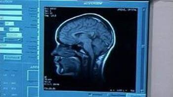 The Teenage Brain | FRONTLINE :: Resources :: California Educators Together