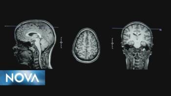 Poisoned Water | The Health Impacts of Lead Exposure :: Resources ...