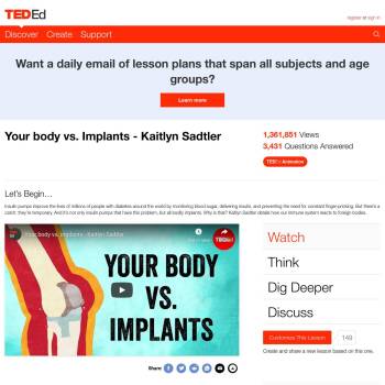 Your body vs. Implants - Kaitlyn Sadtler :: Resources :: California ...